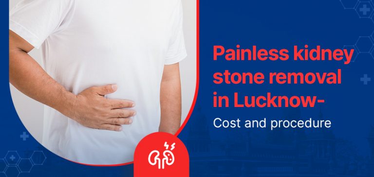 Painless Kidney Stone Removal In Lucknow - Cost And Procedure - GMoney.in