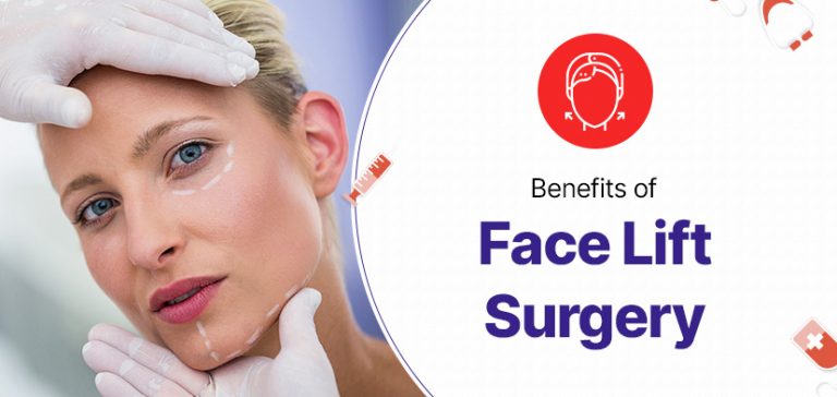 Risks And Benefits Of Face Lift Surgery: What You Should Know - Gmoney.in