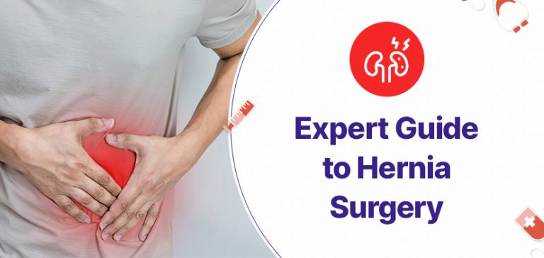 Expert Guide To Hernia Surgery In Mumbai Everything You Need To Know